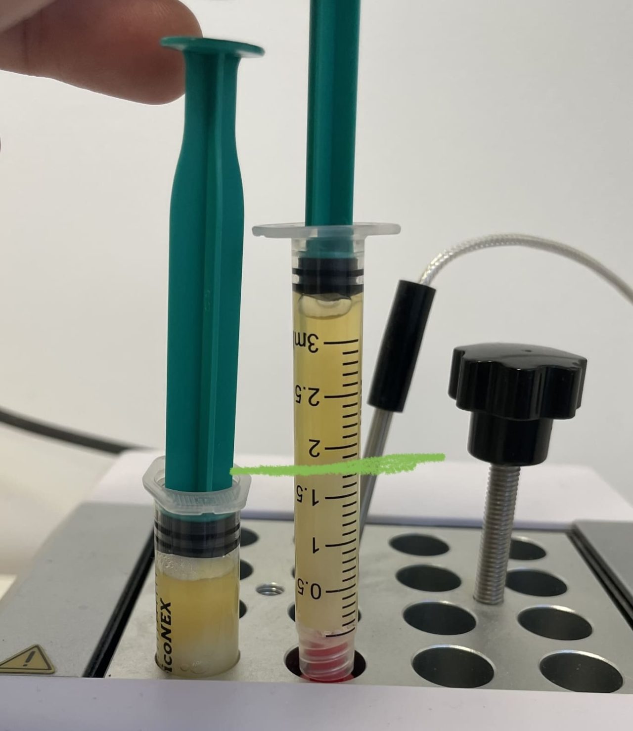 Plasma Rico en Plaquetas en Fascitis Plantar - Cirugia del pie Mallorca